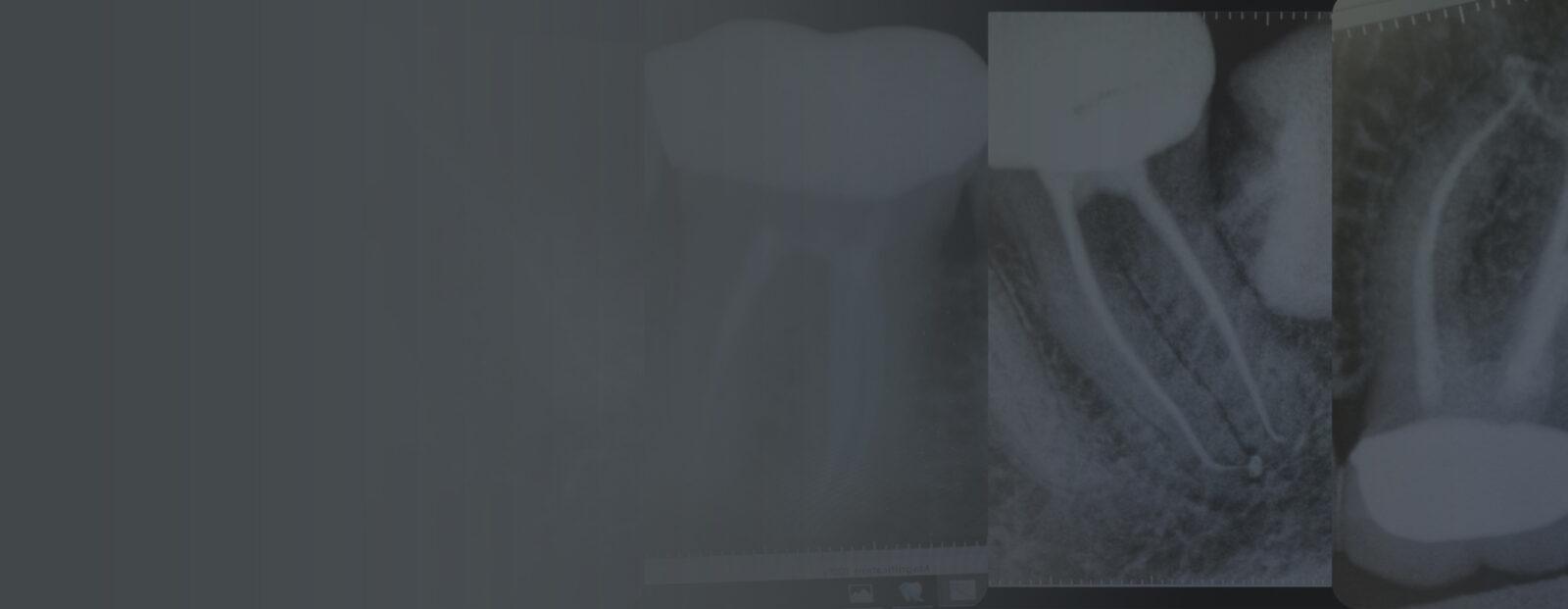 Endodontics | Referral Form - The London Road Dental Practice